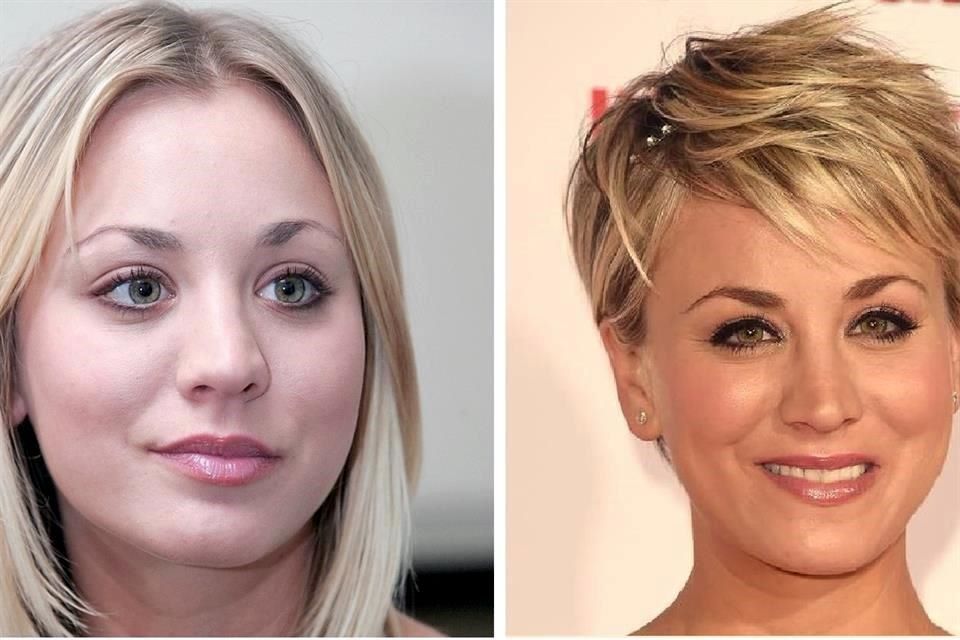 Kaley Cuoco Antes E Depois Dos Implantes Depois De 14 Anos Juntos, Jim