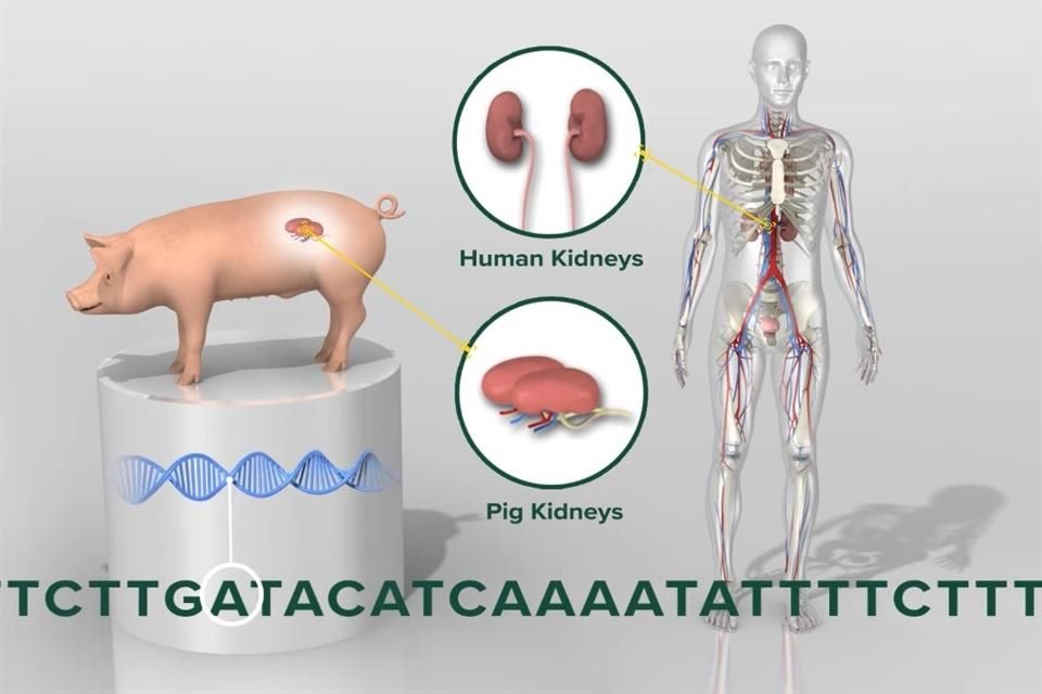 Anatomía Del Cerdo Vs Anatomía Humana
